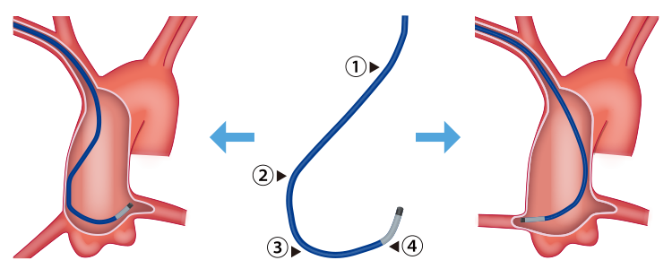 ASAHI Hyperion Ikari | Coronary製品情報 | ASAHI INTECC PRODUCTS